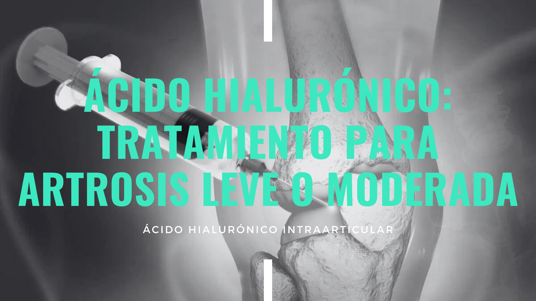 Ácido hialurónico: tratamiento para la artrosis leve y moderada - Dr ...